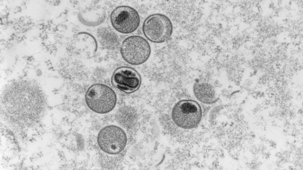 Secondo morto per il vaiolo delle scimmie in Europa