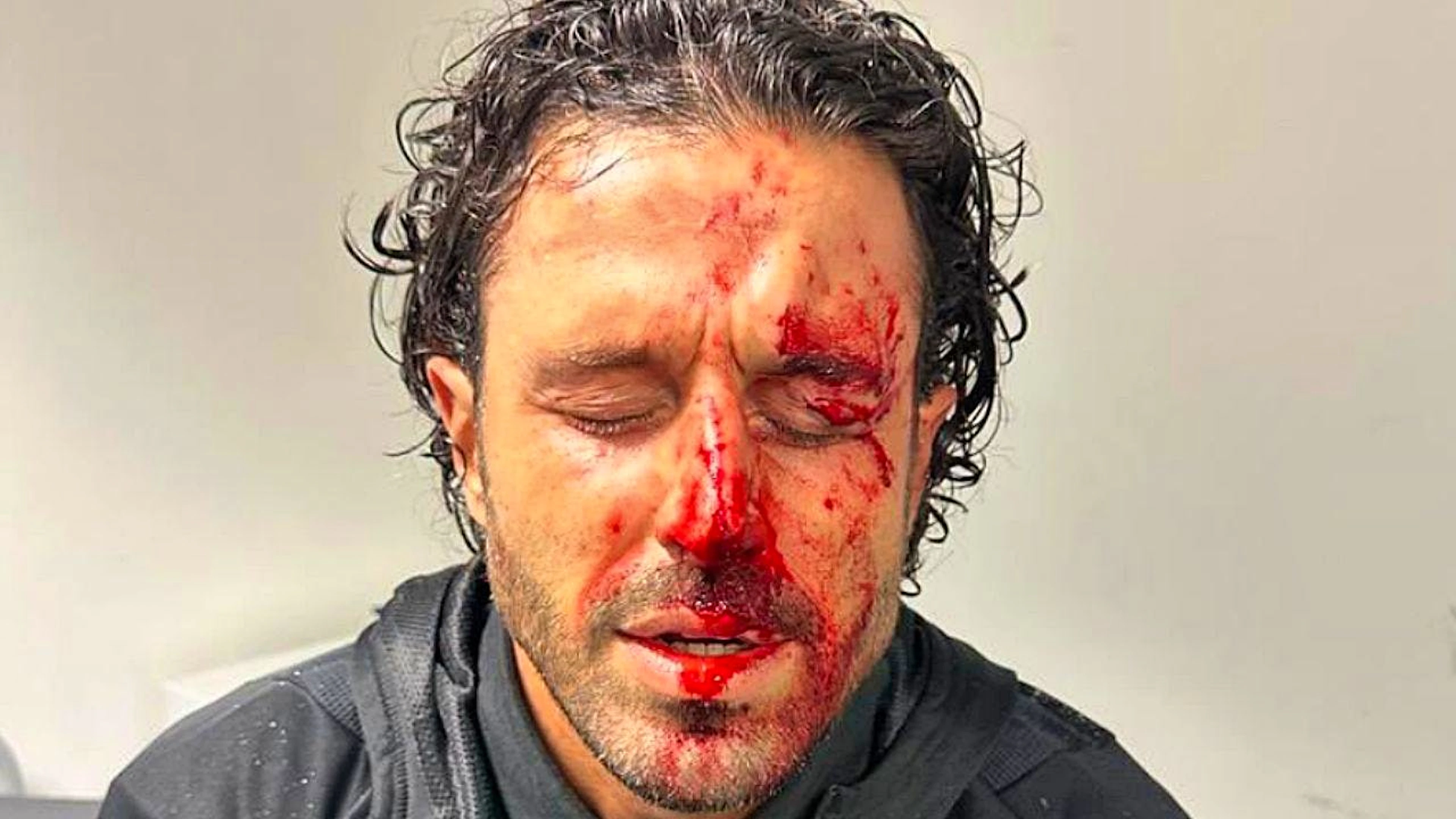 Il Lione attaccato dai tifosi del Marsiglia, ferito l'allenatore Grosso