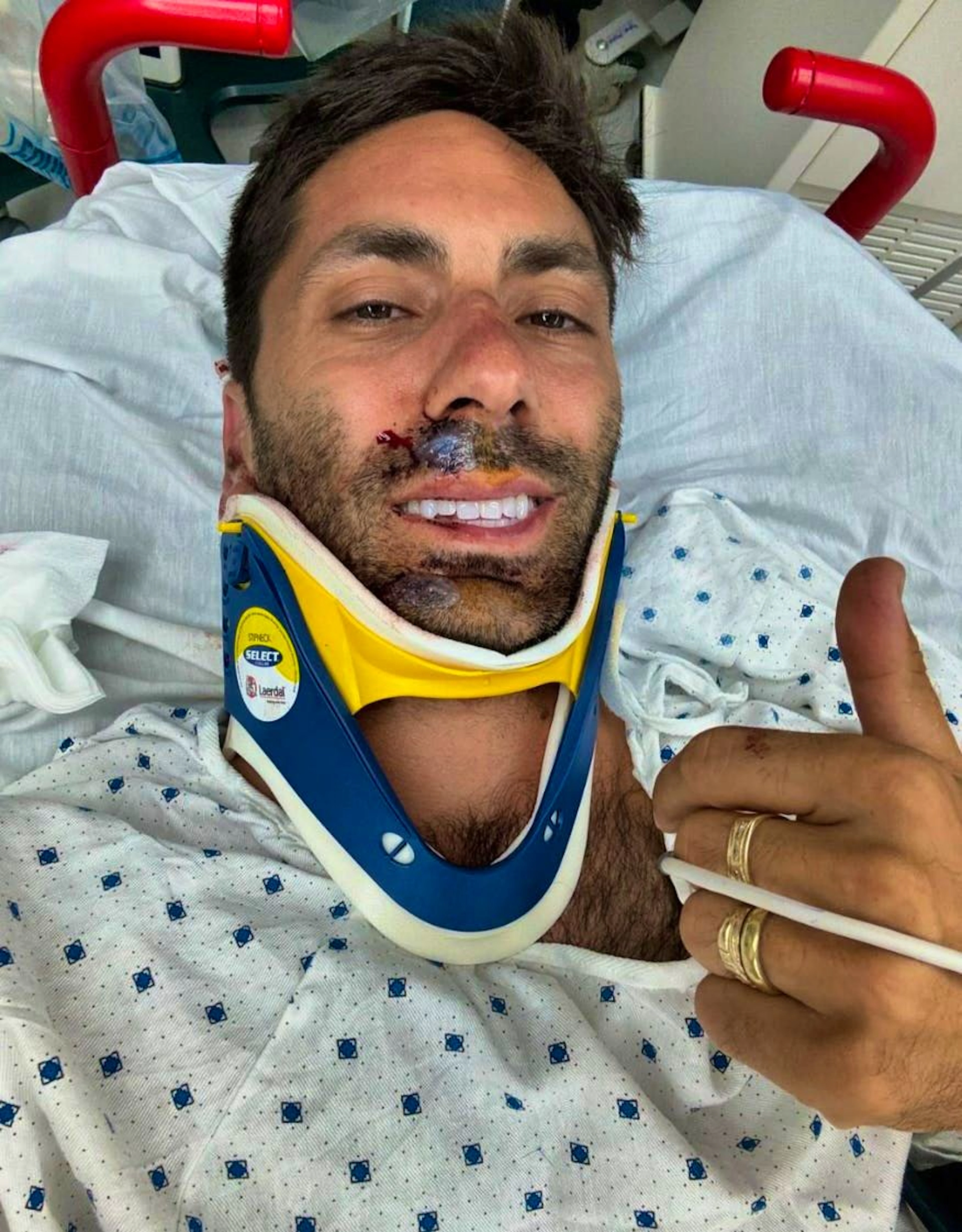 TV star breaks his neck in horror accident - now he's talking