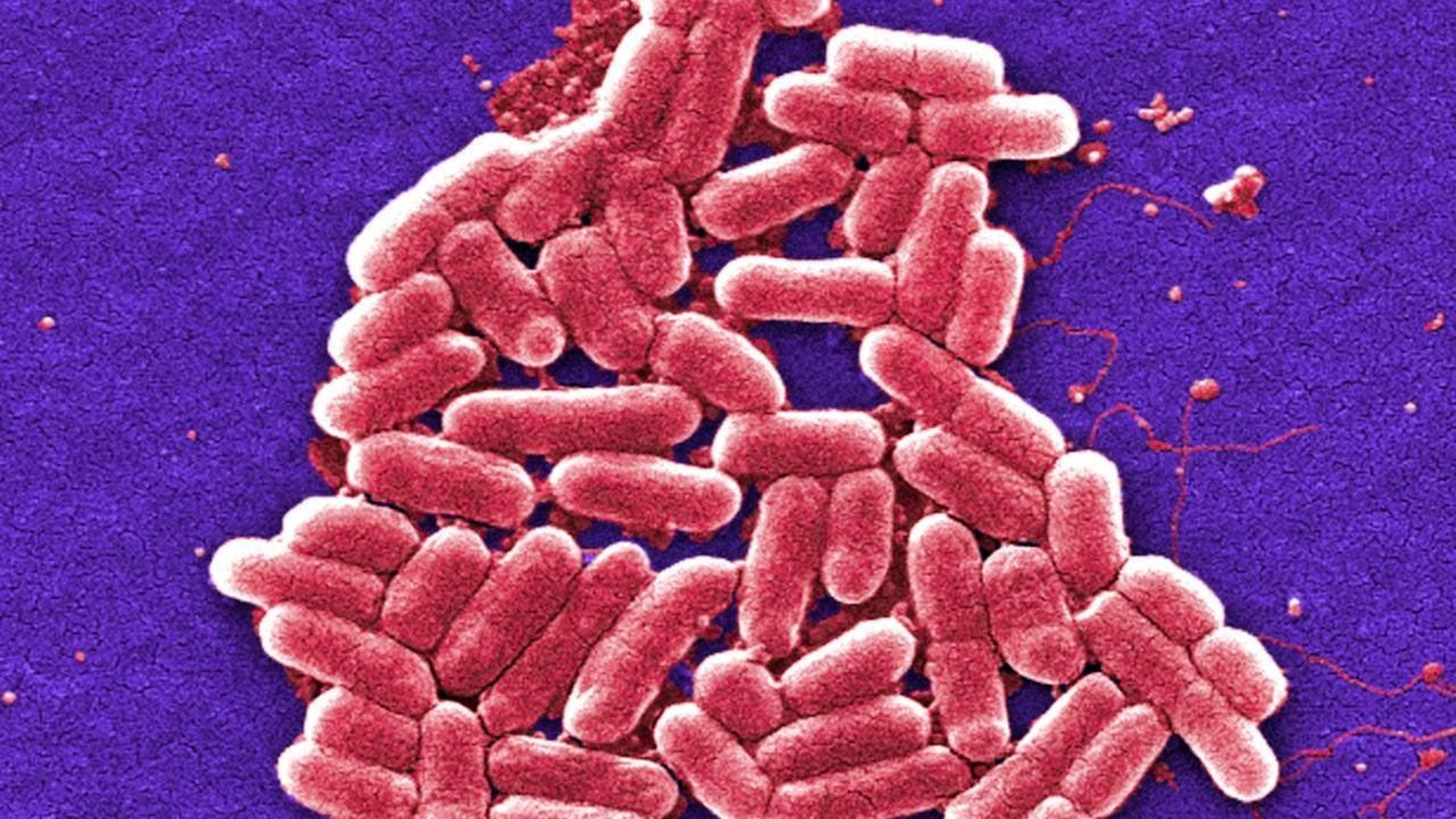 Dyes to clarify cause of drinking water contamination in Uster