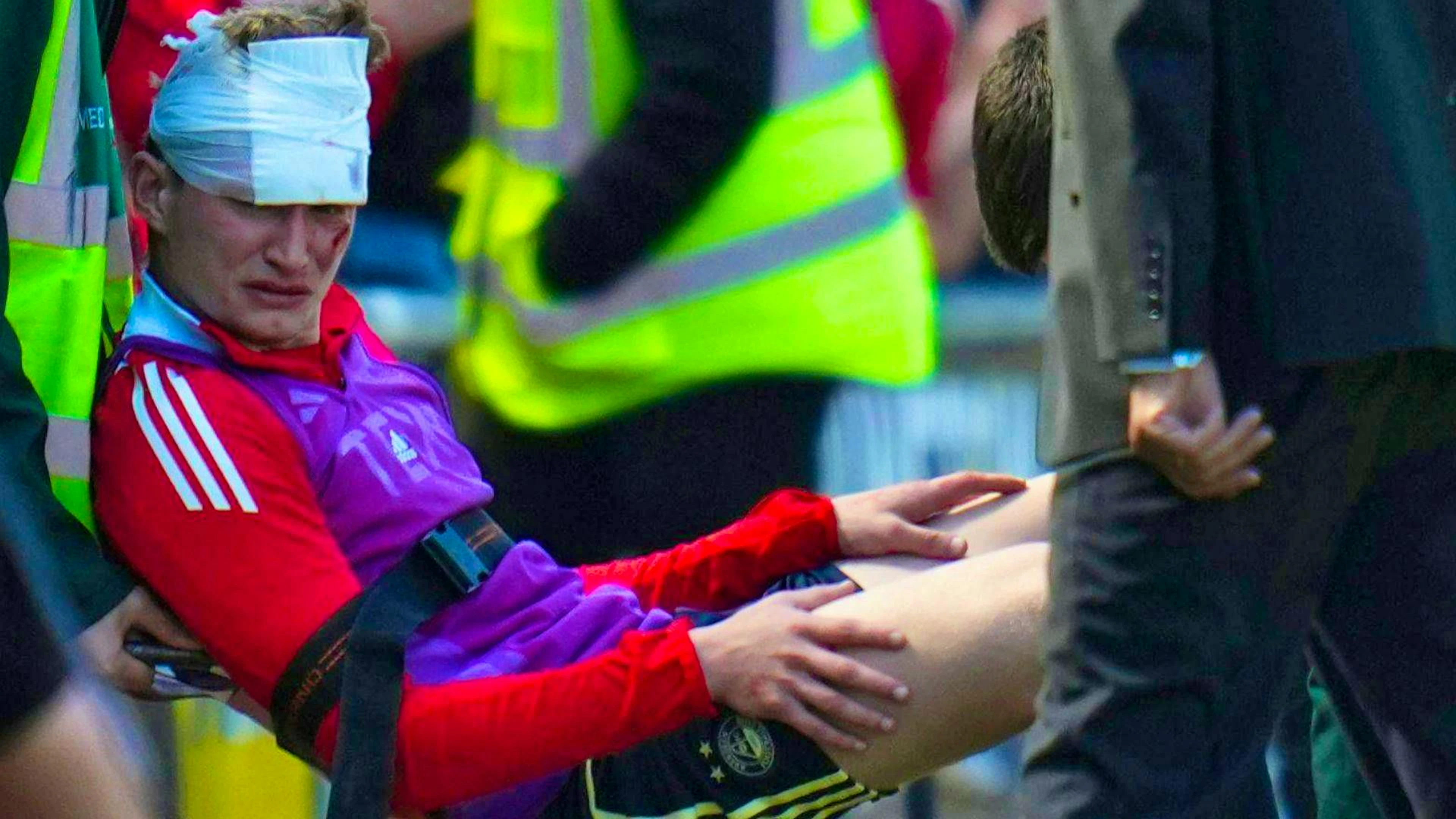 Professional footballer is hit by a seat shell and suffers serious ...