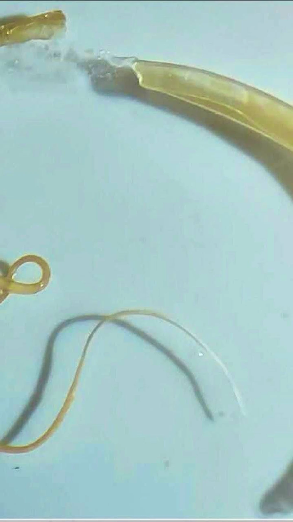Research team at the Tropical Institute discovers new parasitic worm ...