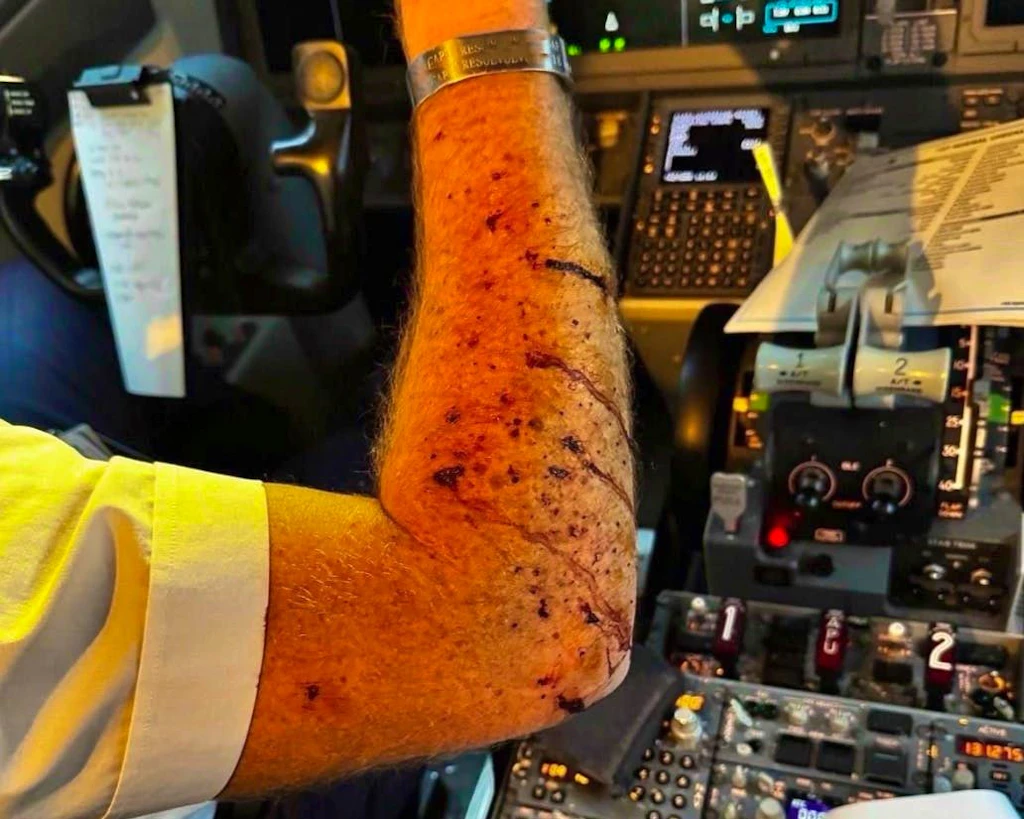 Crack in cockpit window - flight forced to make an emergency landing ...